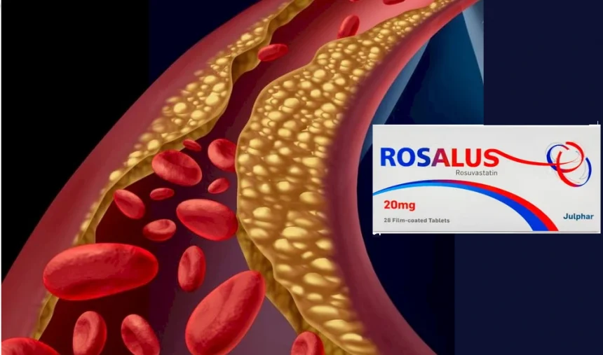 rosalus دواء كوليسترول روسوفاستاتين 10 أو 20 مجم أقراص | drug5m